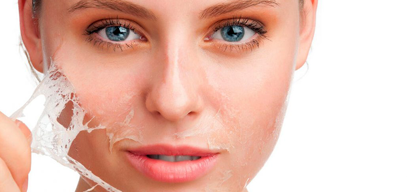 Peelingurile chimice – o altă faţă! - www.medicdermatologieiasi.ro