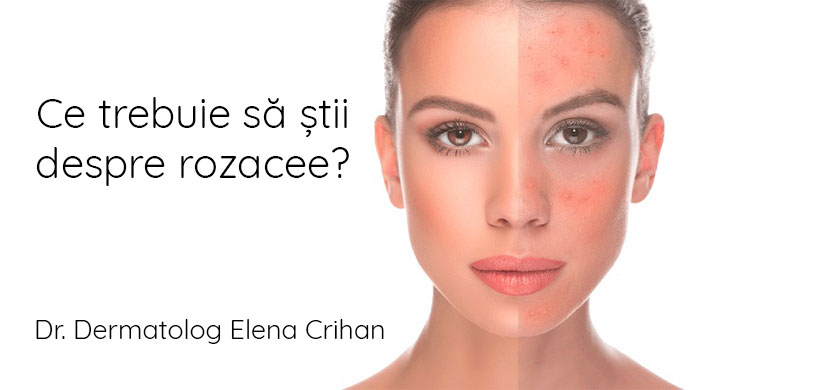 Diagnosticat cu rozacee